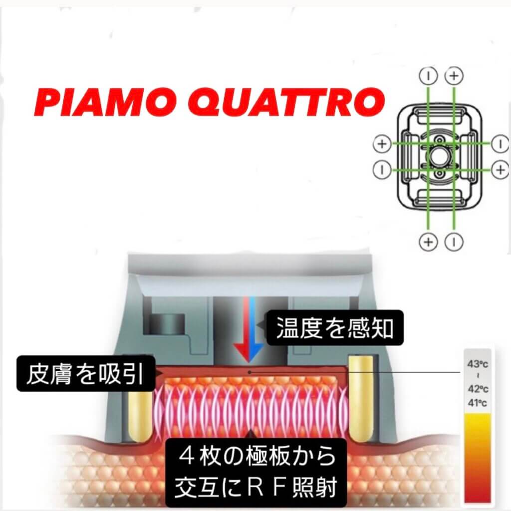 PIAMO 関西初導入 - 大阪いけだクリニック 黒崎泰史ドクターブログ